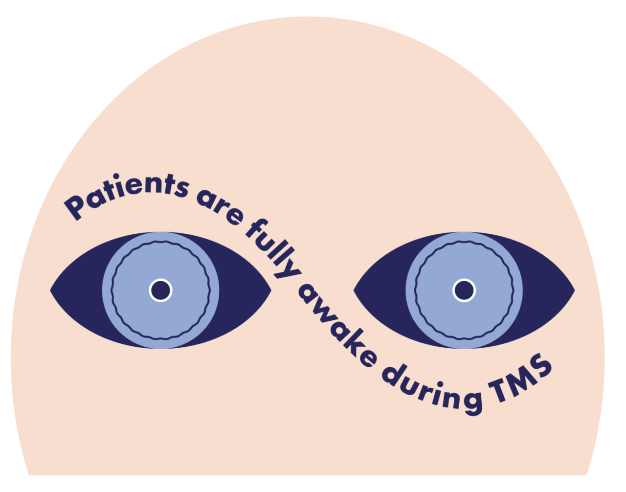 Pulse TMS TMS History - Pulse TMS