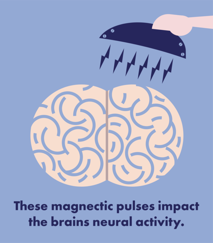 Pulse TMS TMS History - Pulse TMS